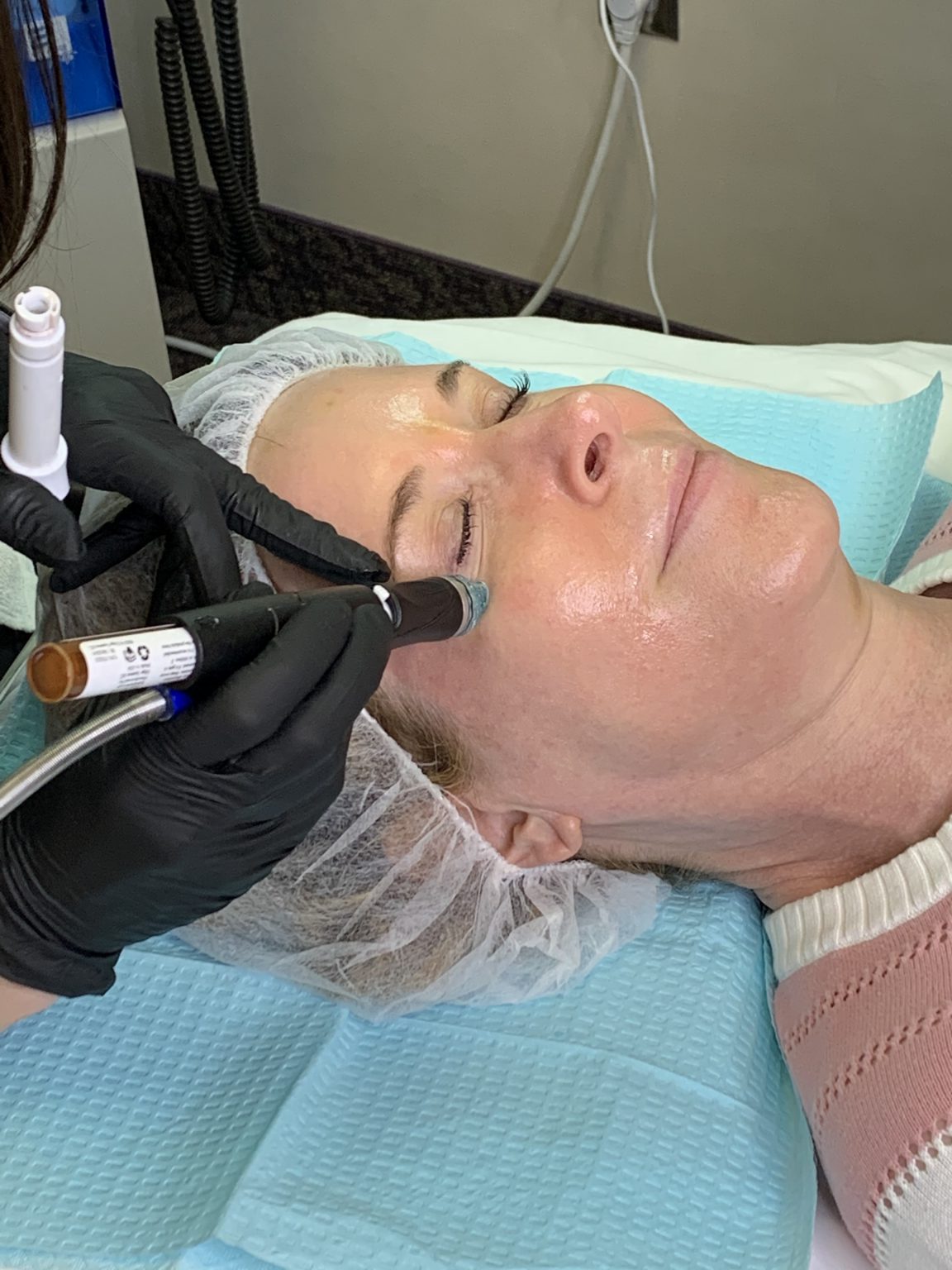 The HydraFacial: A Brightening, Glow-Inducing Treatment for Your Skin